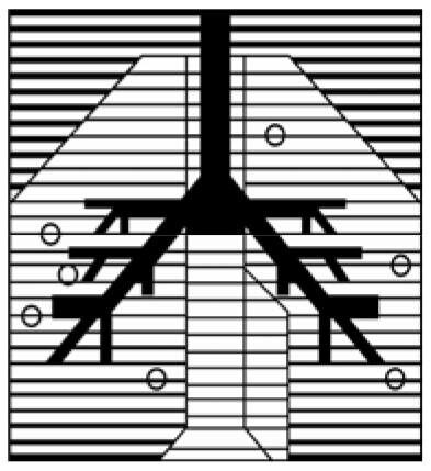 SOCALPAR – Sociedad Castellanoleonesa y Cántabra de patología respiratoria